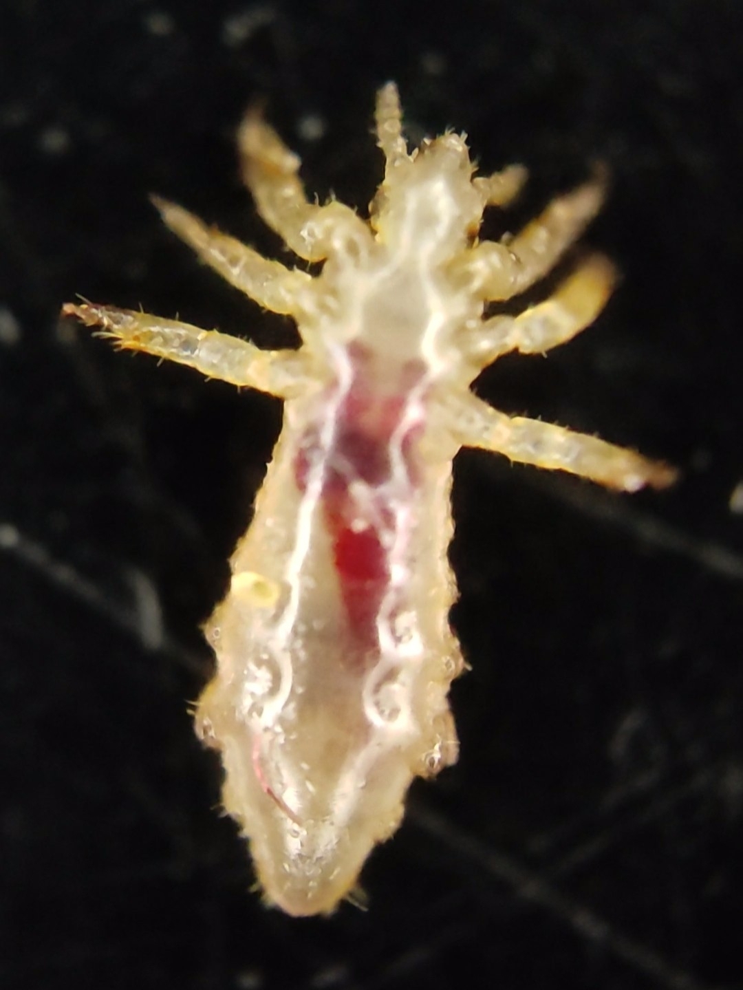 Pediculidae