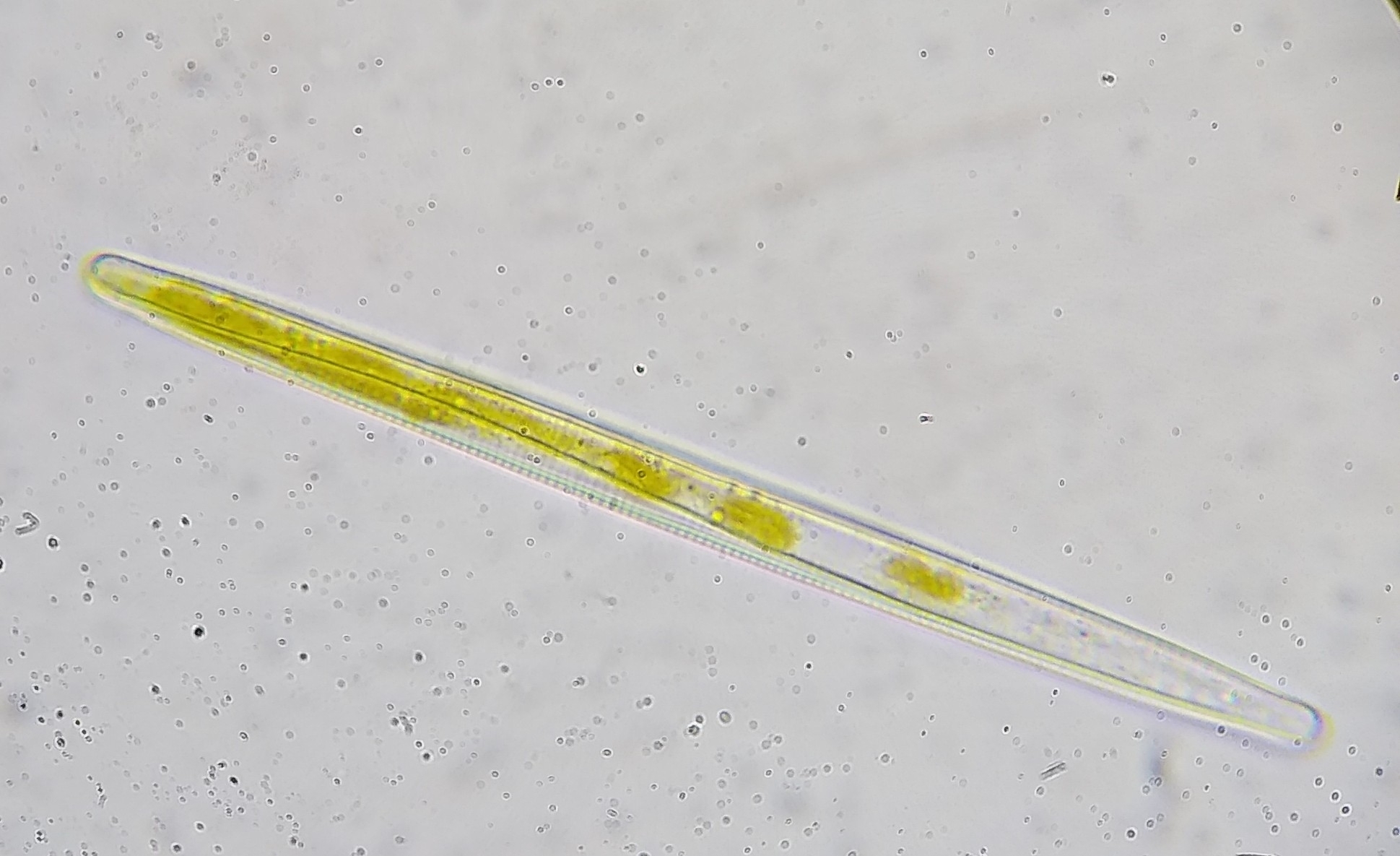 Synedra ulna (Nitzsch) Ehrenberg, 1832