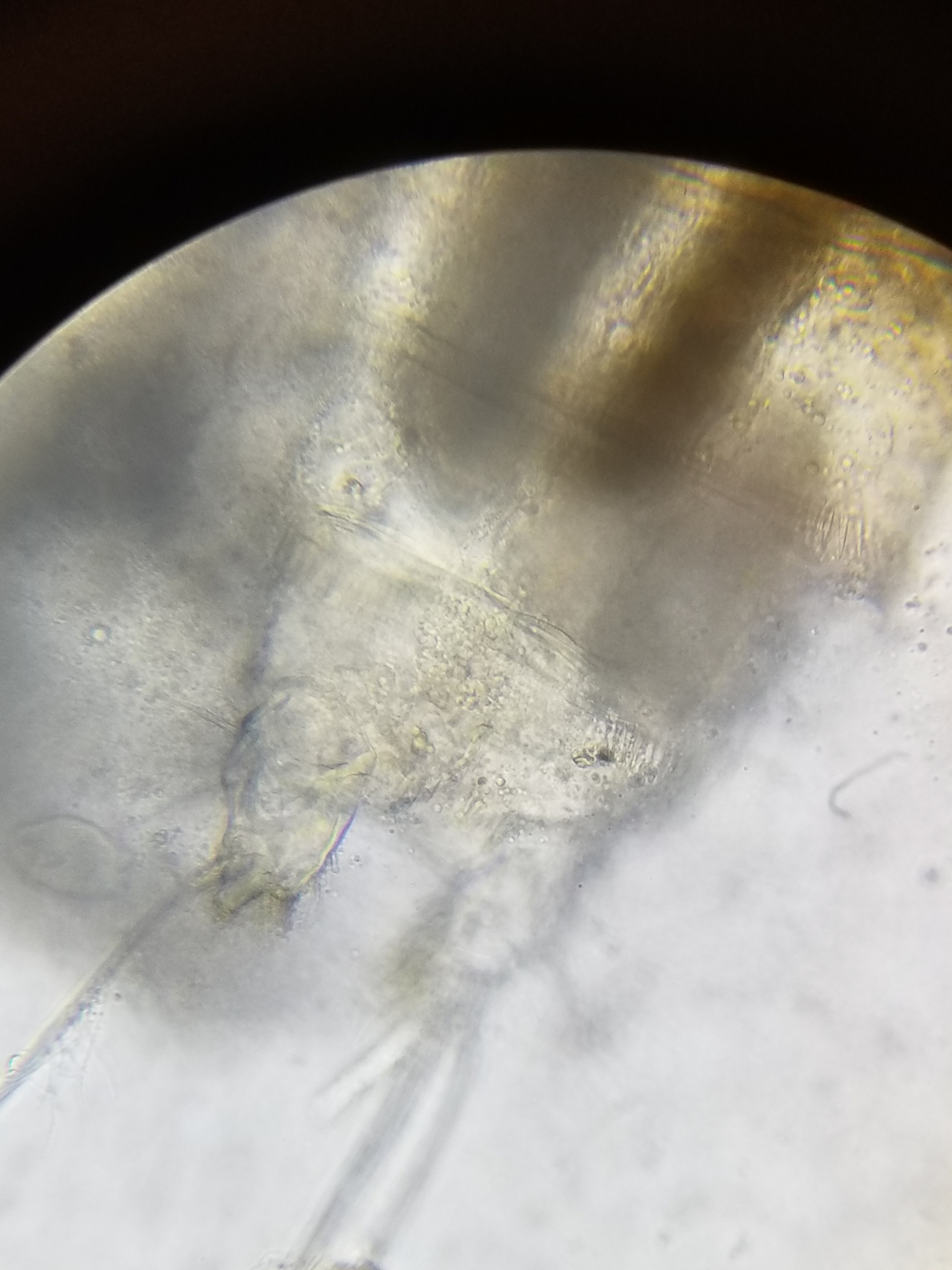 Canthocamptidae