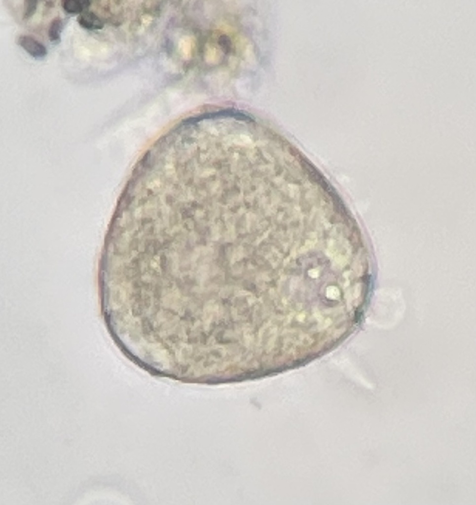 Ciliates from Tandy Hills Natural Area, Fort Worth, TX, US on April 07 ...