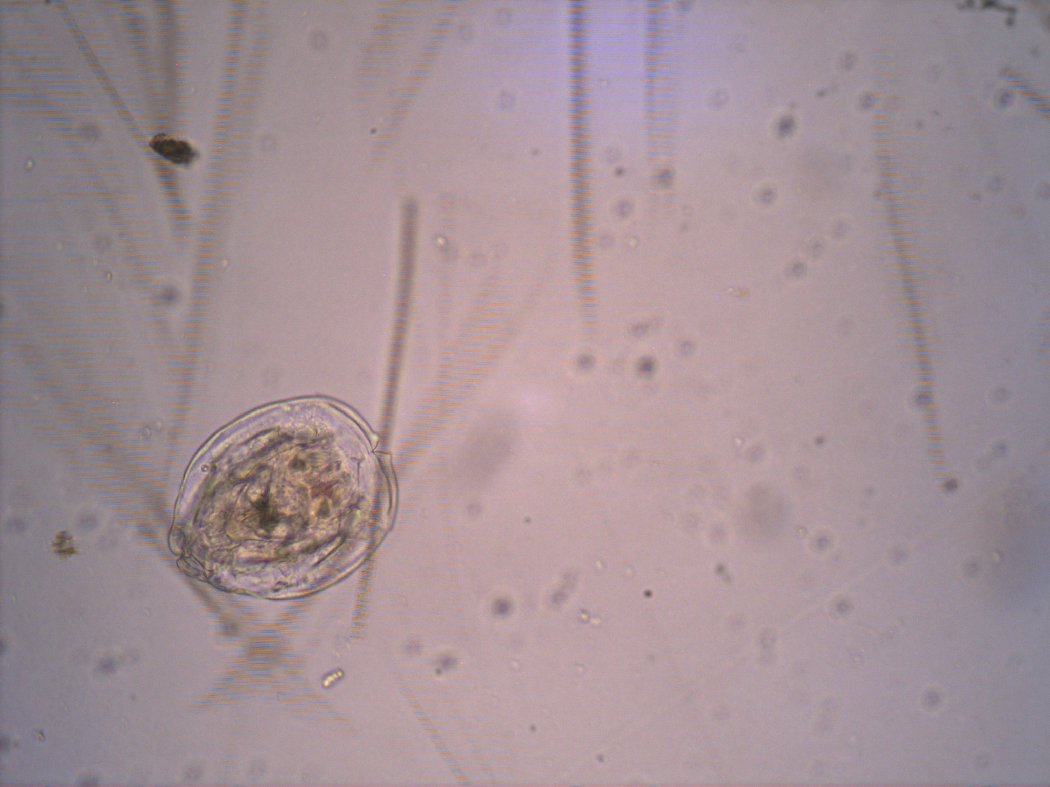 Brachionus angularis Gosse, 1851