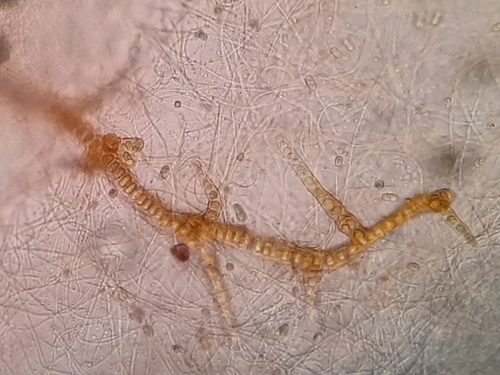 Genus Fischerella · iNaturalist