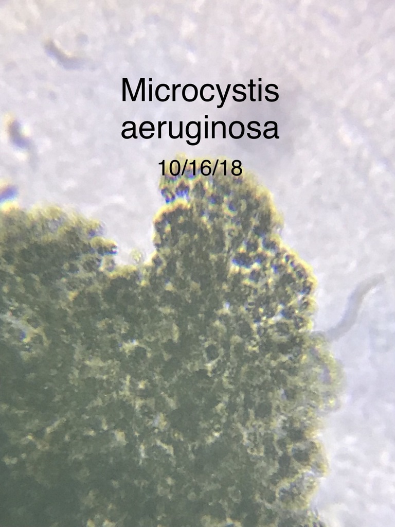 Microcystis aeruginosa from Caloosahatchee River estuary on October 16 ...