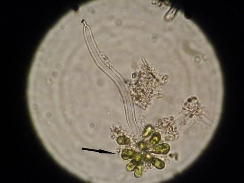 (Ophiocytium)