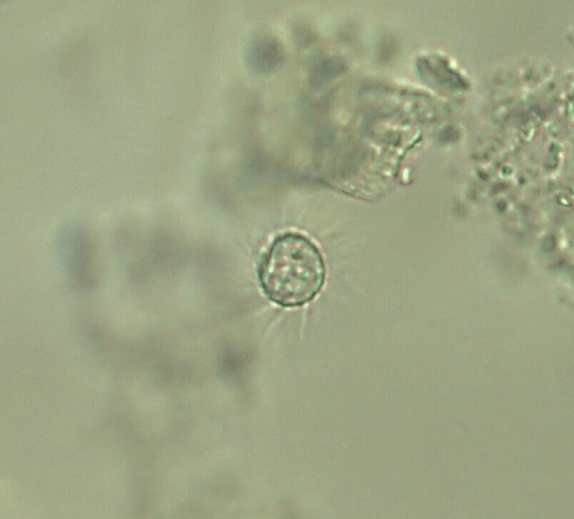 Halteria from Mexico City, CDMX, Mexico on April 21, 2023 at 06:16 PM ...