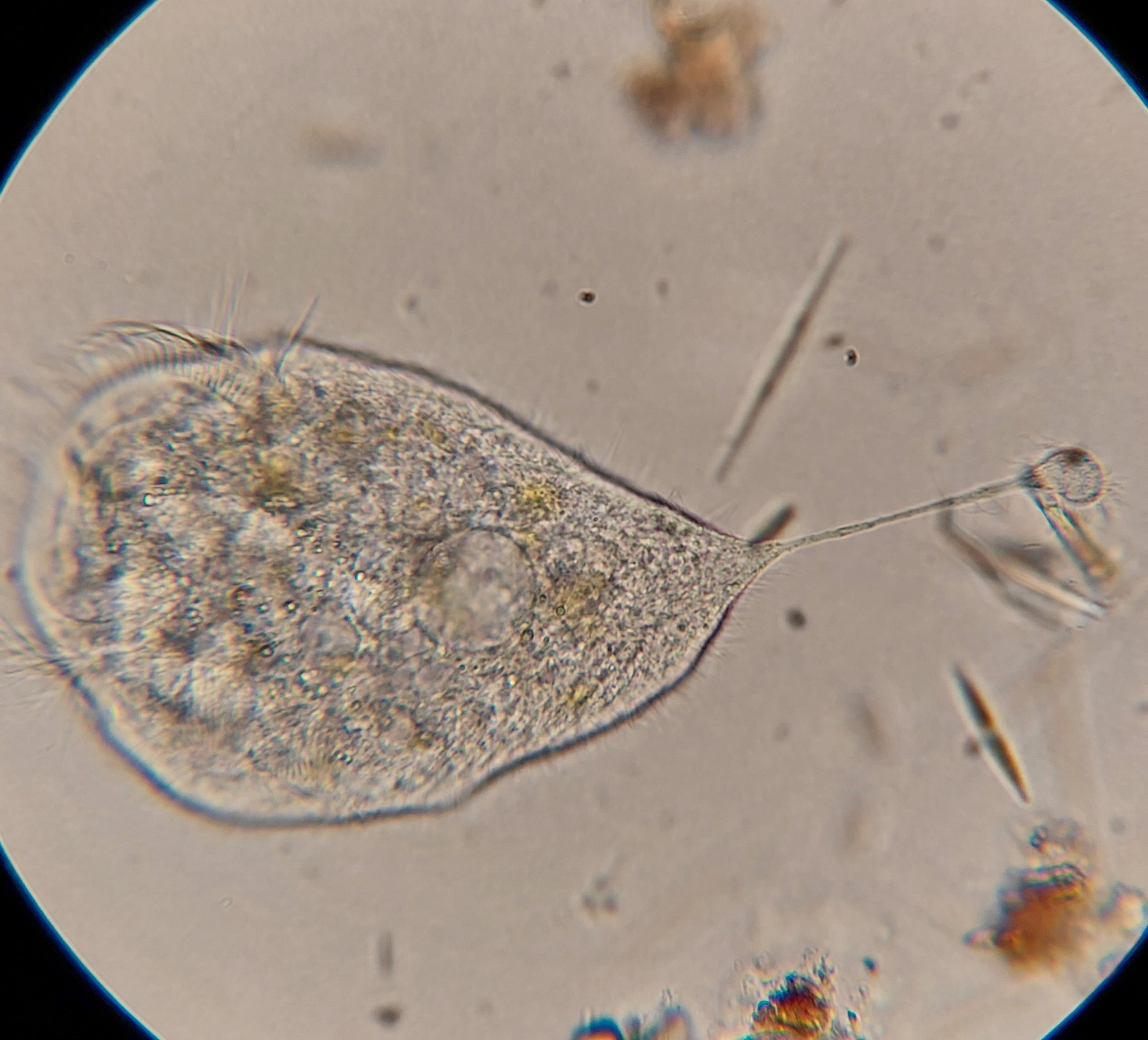 Stentor roeselii Ehrenberg, 1835