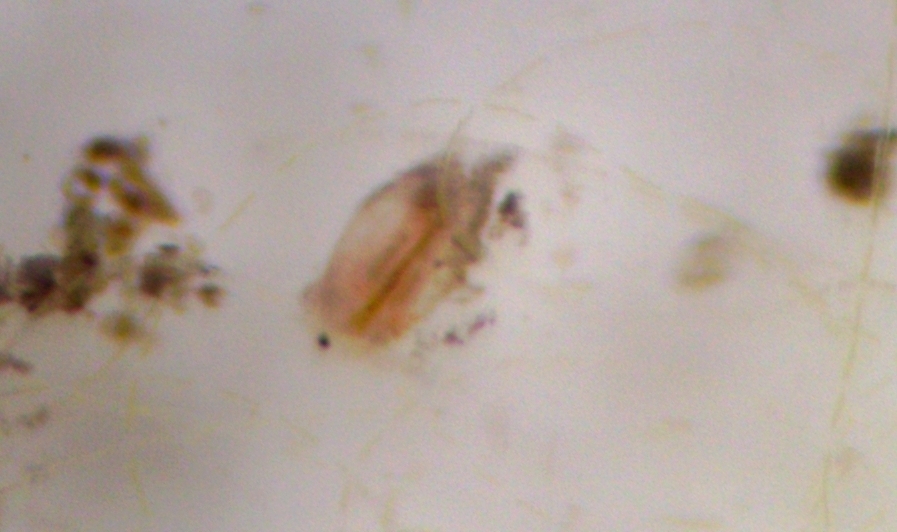 Water-fleas from Mickleton, East Greenwich Township, NJ 08056, USA on ...