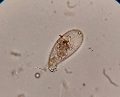 Cyphoderia ampulla · NaturaLista Colombia