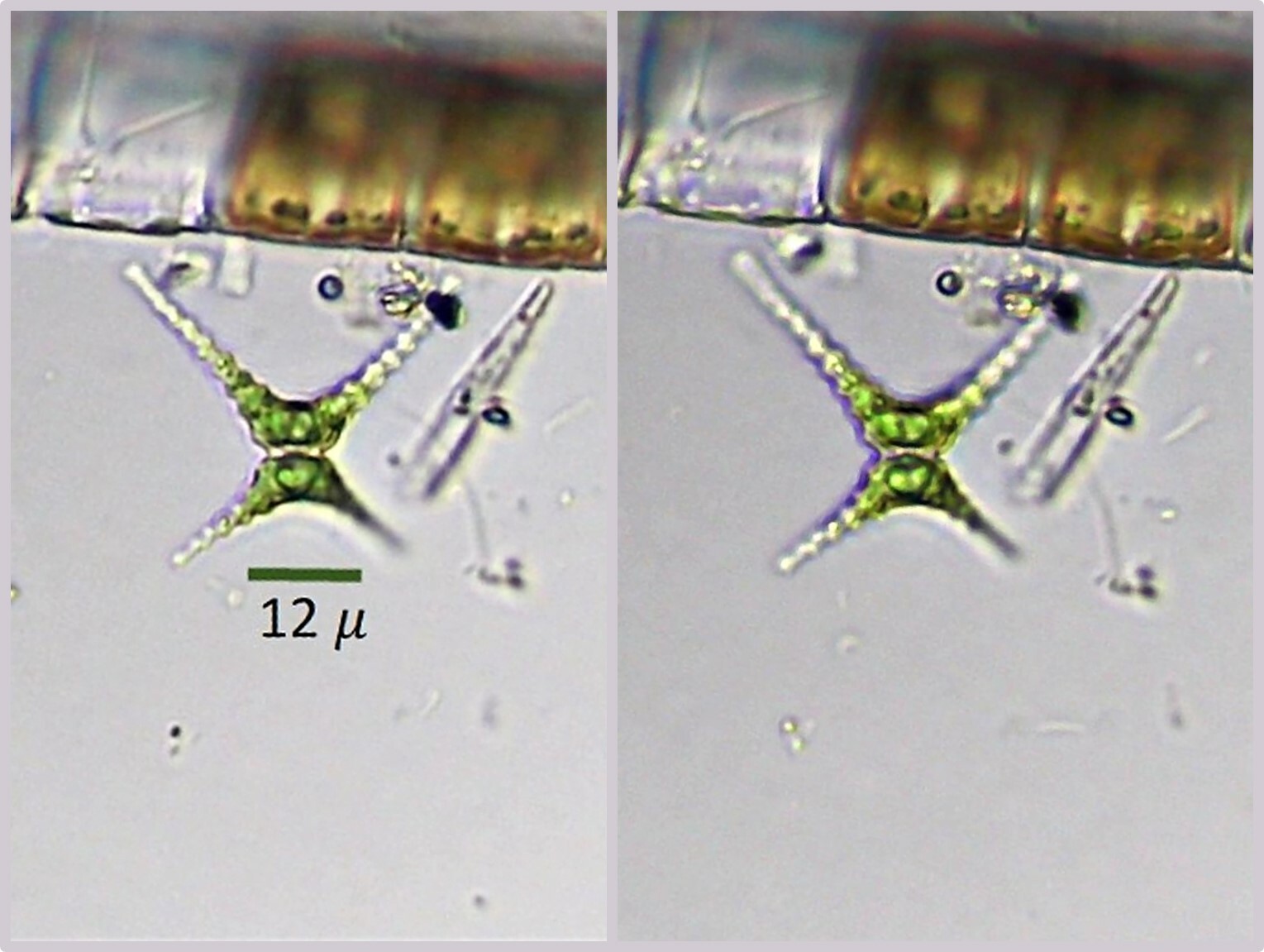 Staurastrum tetracerum Ralfs