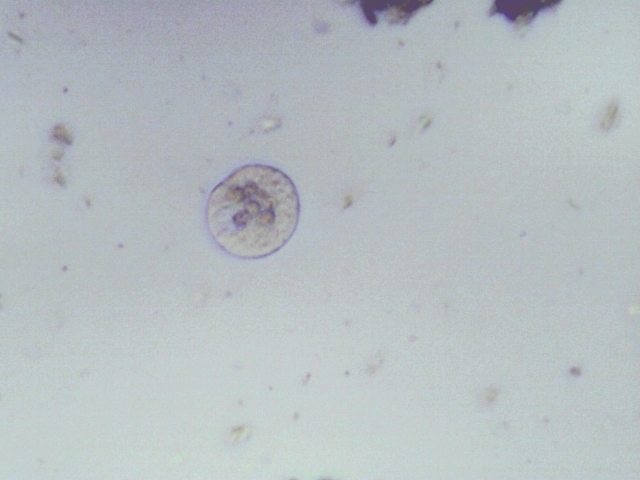 Entamoebidae (amoebas of the world) · iNaturalist