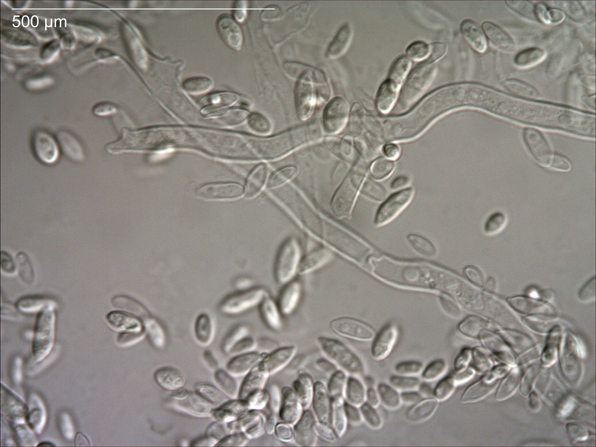 Aureobasidium pullulans (de Bary & Löwenthal) G.Arnaud