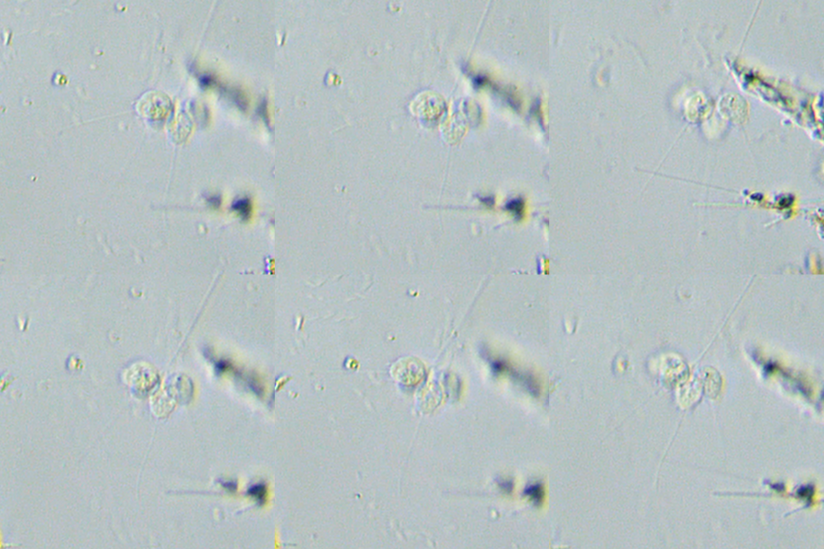 Choanoflagellatea