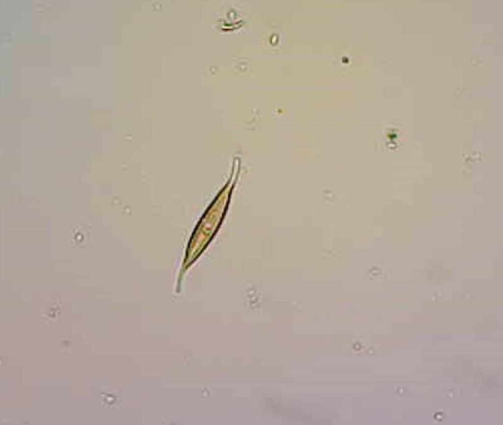 Gyrosigma fasciola from Crescent Beach, Fl on January 6, 2016 by Sarka ...