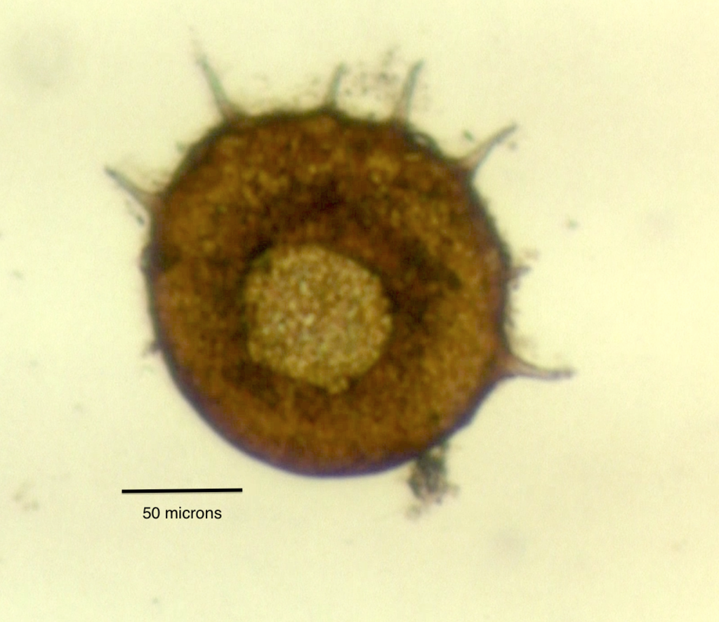 Centropyxis discoides (amoebas of the world) · iNaturalist