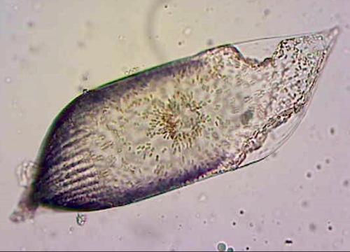 Fitoplancton (Neocalyptrella robusta)