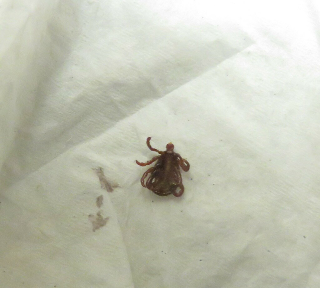 Hardbacked Ticks from Knapp Brook Pond Number 1, Vermont, USA on June ...