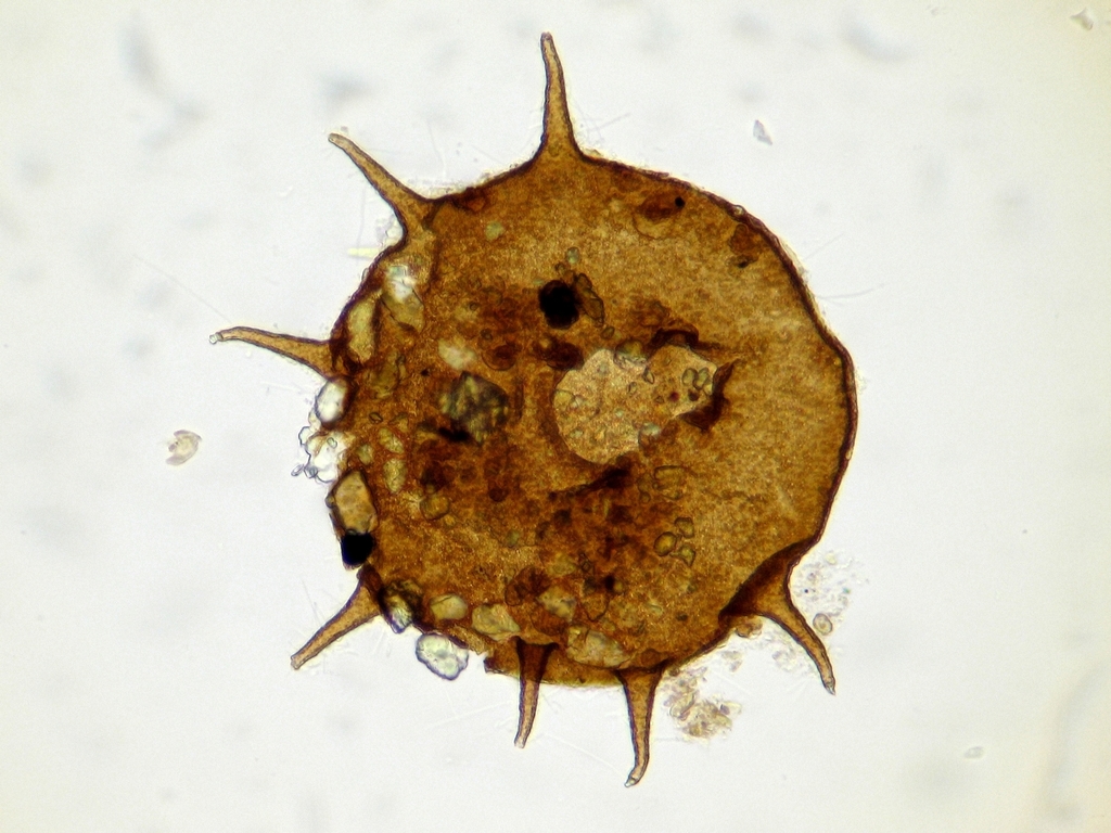 Centropyxis aculeata (amoebas of the world) · iNaturalist