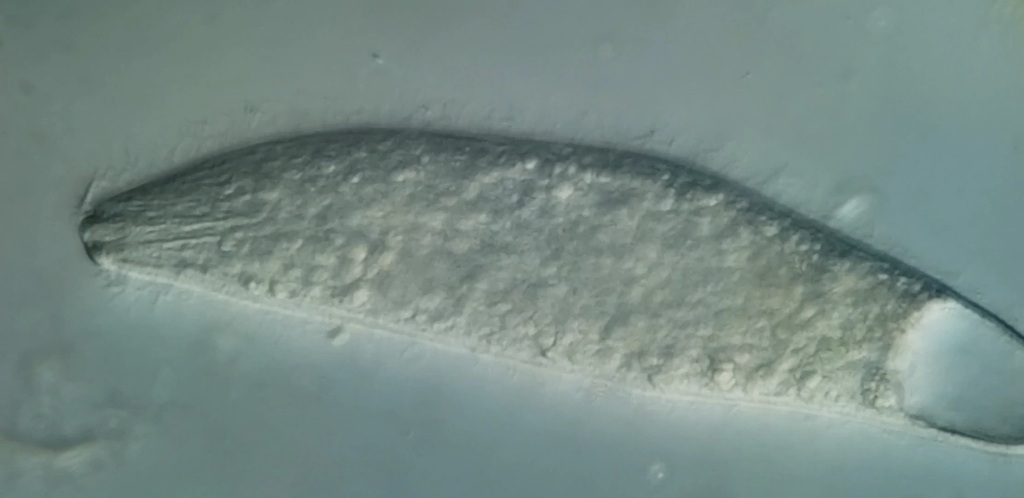 Spathidium opimum from Amagansett, NY, USA on June 22, 2023 at 02:40 PM ...