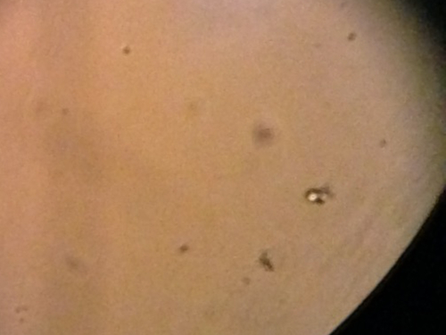 Pediococci (Genus Pediococcus) · iNaturalist