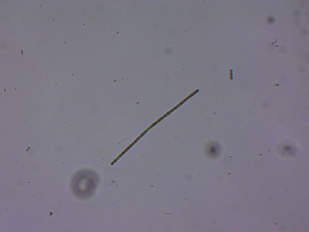 Dolichospermum from Vancouver Lake Shillapoo Wildlife Area on July 31 ...