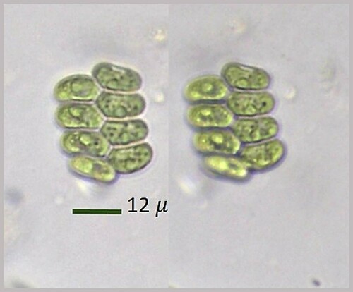 Protococcus Under Microscope