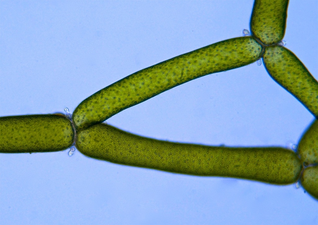 Water Nets (Hydrodictyon) - Botanical Realm