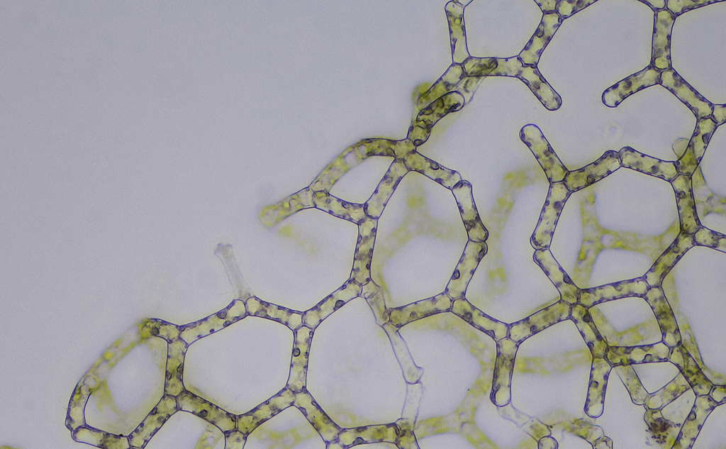 Water Nets (Hydrodictyon) - Botanical Realm