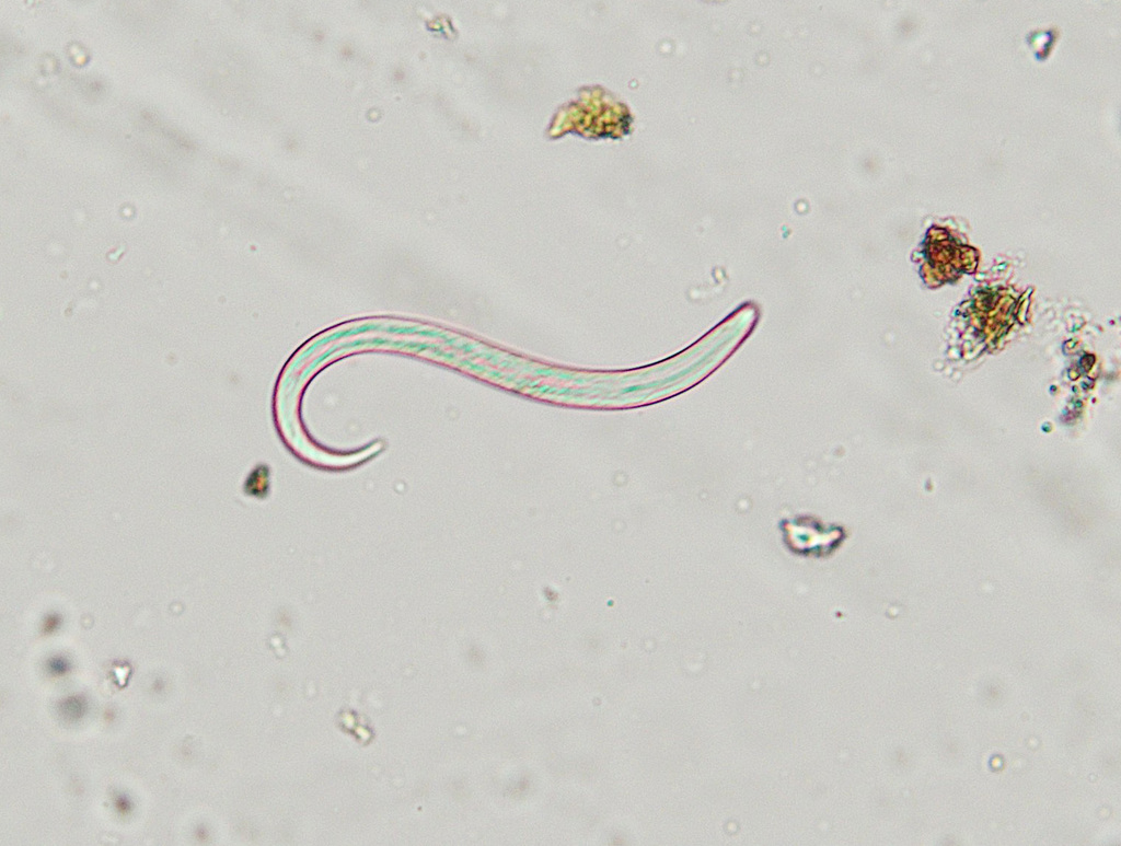 Plectus from Turitea, New Zealand on August 10, 2023 at 01:08 PM by ...