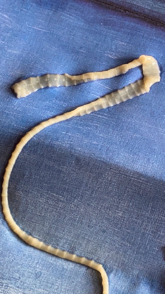 Diphyllobothrium from Haida Gwaii, Daajing Giids, BC, CA on August 4 ...