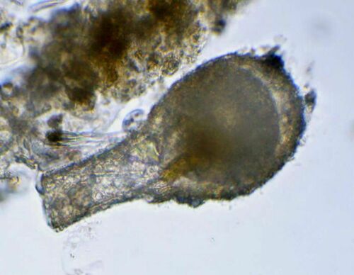 Difflugia bacillifera · iNaturalist