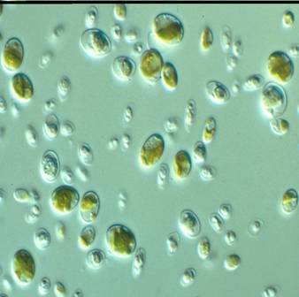 Chlorella (Bacteria and "Protists" of Travis County, TX; USA) · iNaturalist
