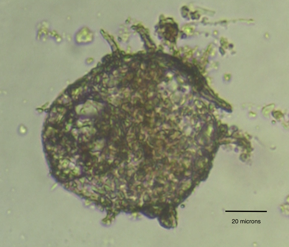Centropyxis aculeata (Ehrenberg, 1832) Stein, 1859