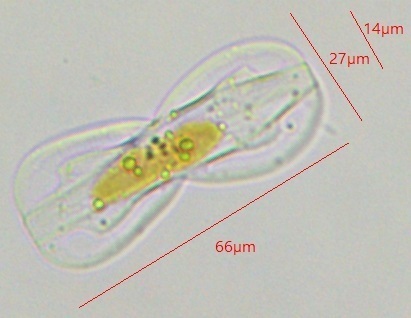 (Entomoneis paludosa)