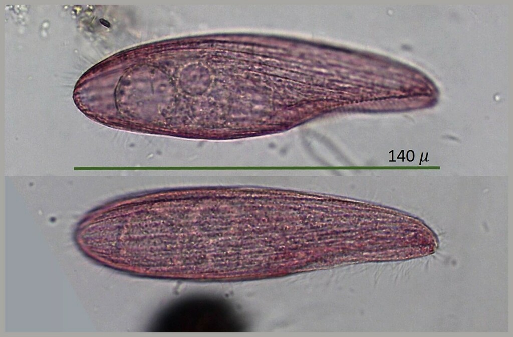 Blepharisma americanum from Ledyard, CT, USA - Sawmill Park on ...