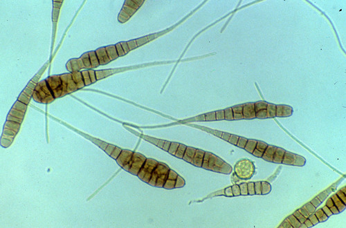 Alternaria porri · iNaturalist