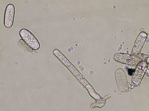 Genus Uncinula · iNaturalist