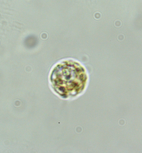 Genus Ochromonas · iNaturalist