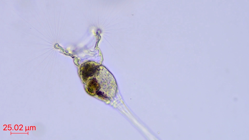 Collotheca ornata from 日本、宮城県仙台市泉区 on August 8, 2021 by amayakan. Video ...