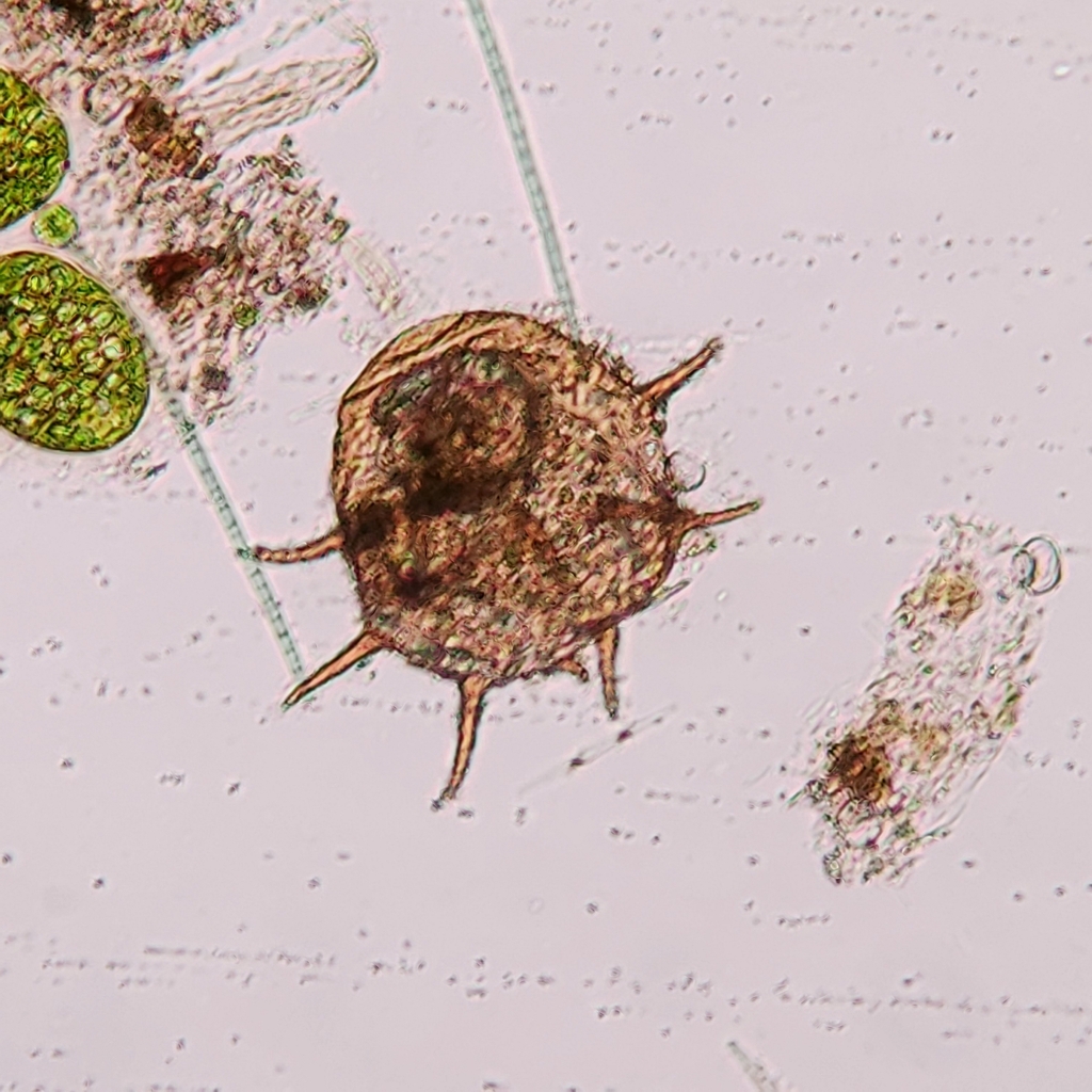 Centropyxis spinosa from Wainfleet Bog stream, Regional Municipality of ...