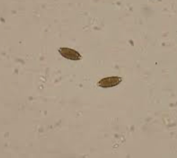 Dog Roundworm from Perard St, Lafayette, LA, US on November 8, 2023 at ...