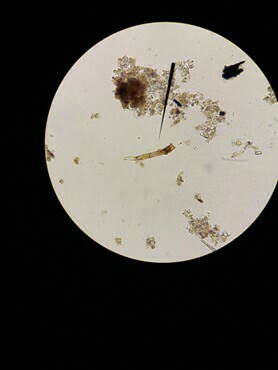 Microspora from Villavicencio, Meta, Colombia by angie_ale · iNaturalist