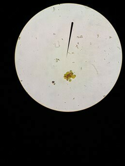 Asterococcus limneticus from Villavicencio, Meta, Colombia by angie_ale ...