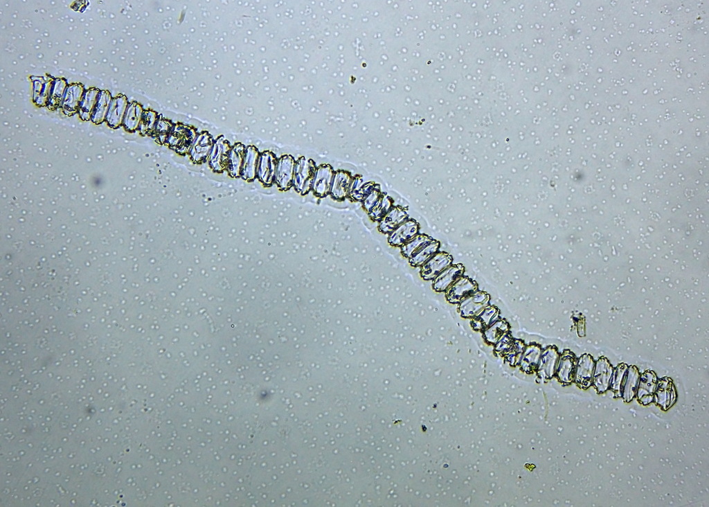 Desmidium from Lake Hawkins area pond, Texas 75765 on December 1, 2023 ...