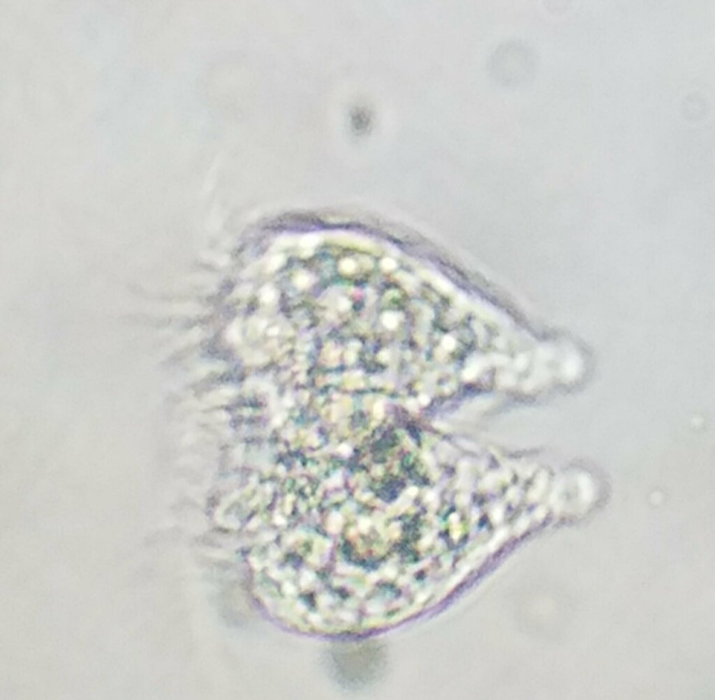 Strobilidium caudatum from Olympia Heights, FL, USA on December 2, 2023 ...