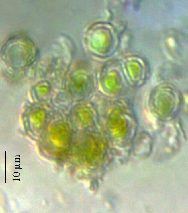Apatococcus lobatus from H9WJ+Q3C National Botanical Garden, Satdobato ...