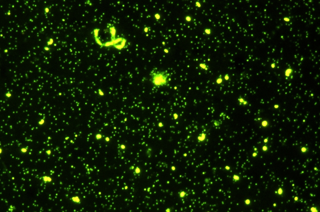 viruses from saskatoon on July 18, 1995 by David Bird. Bacteriophages ...