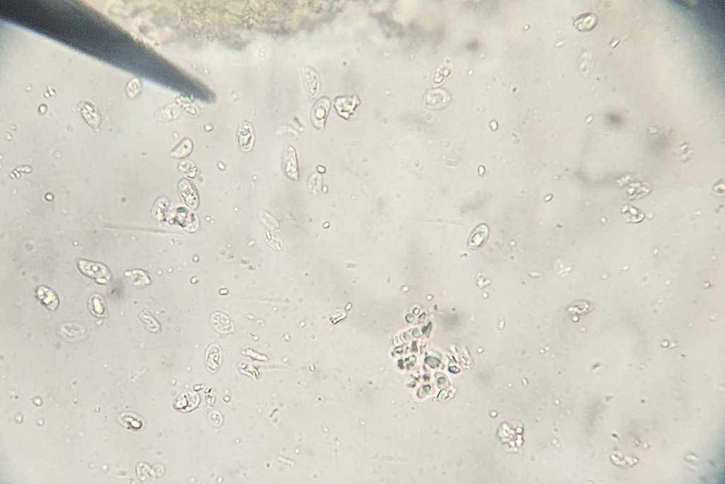 liverwort navel from 201 N Bellefield Ave, Pittsburgh, PA 15213, USA on ...
