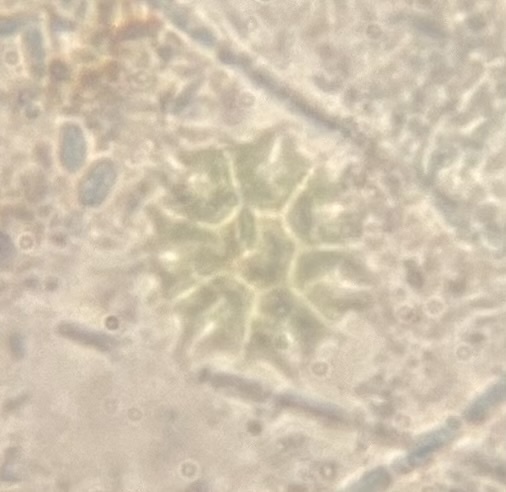 Stauridium tetras from Lake Okeechobee, Okeechobee, FL, US on December ...