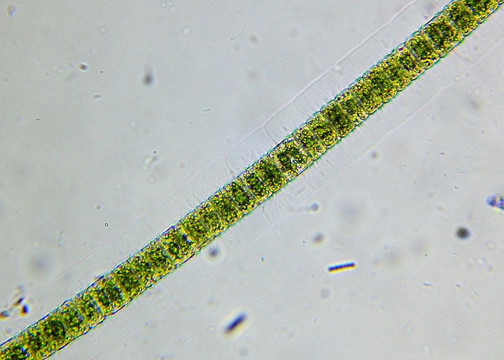 Hyalotheca from Lake Hawkins area pond, Texas 75765 on December 15 ...