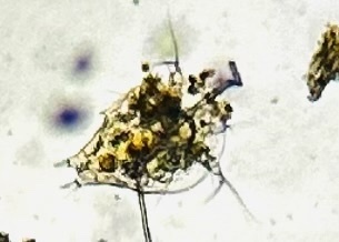 Copepods from SW 130th Ave, Miami, FL, US on December 10, 2023 at 10:26 ...